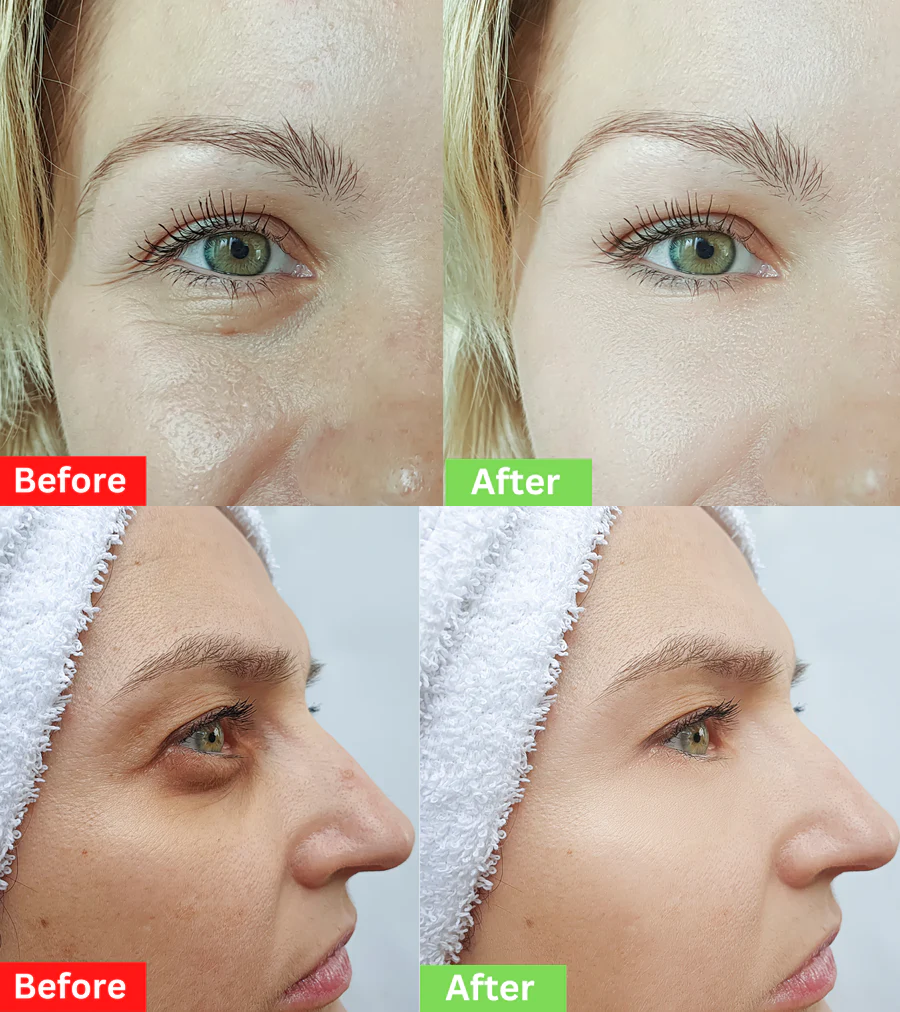 Instant Firm Eye Tightening Cream – Berbax